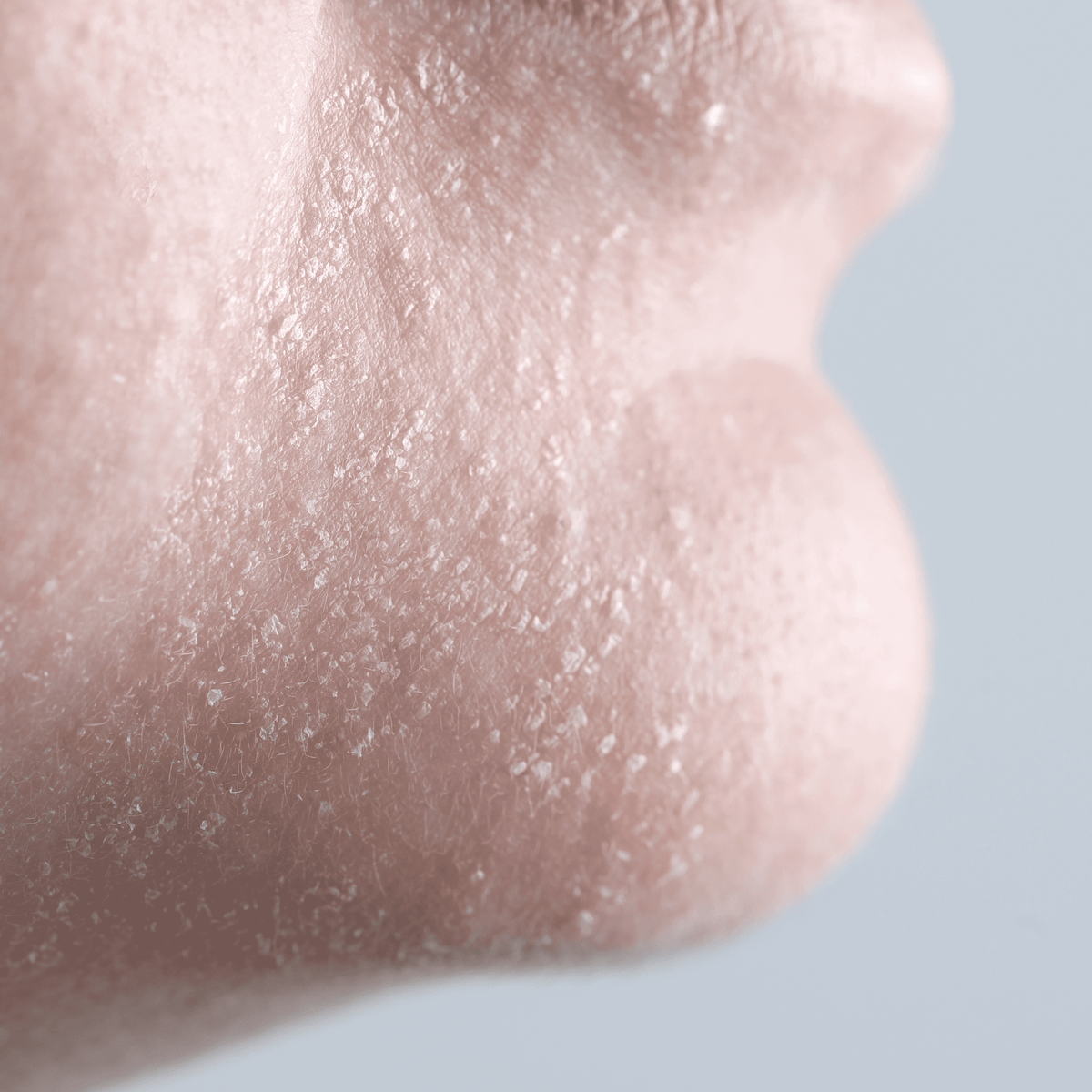 DEHYDRATION – dermeden.paris