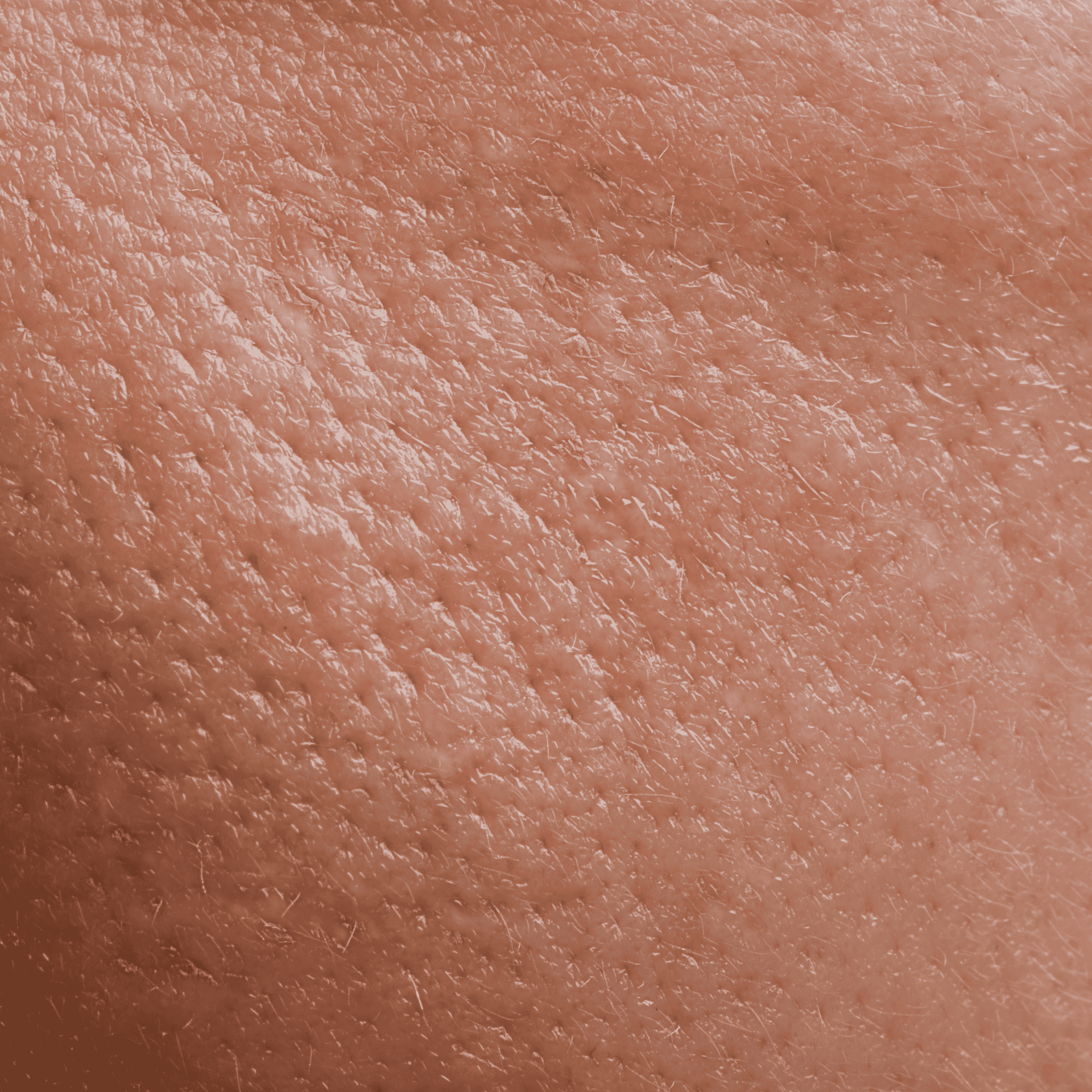 EXCÈS DE SÉBUM – dermeden.paris